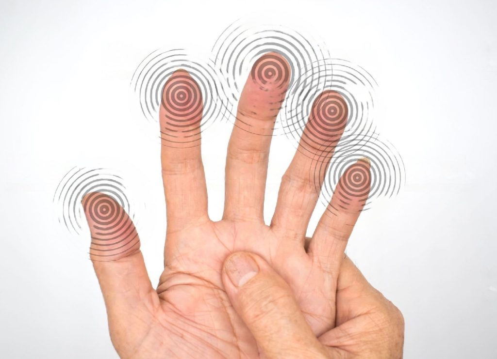 ¿Qué puede Causar Hormigueo en las manos y brazos?